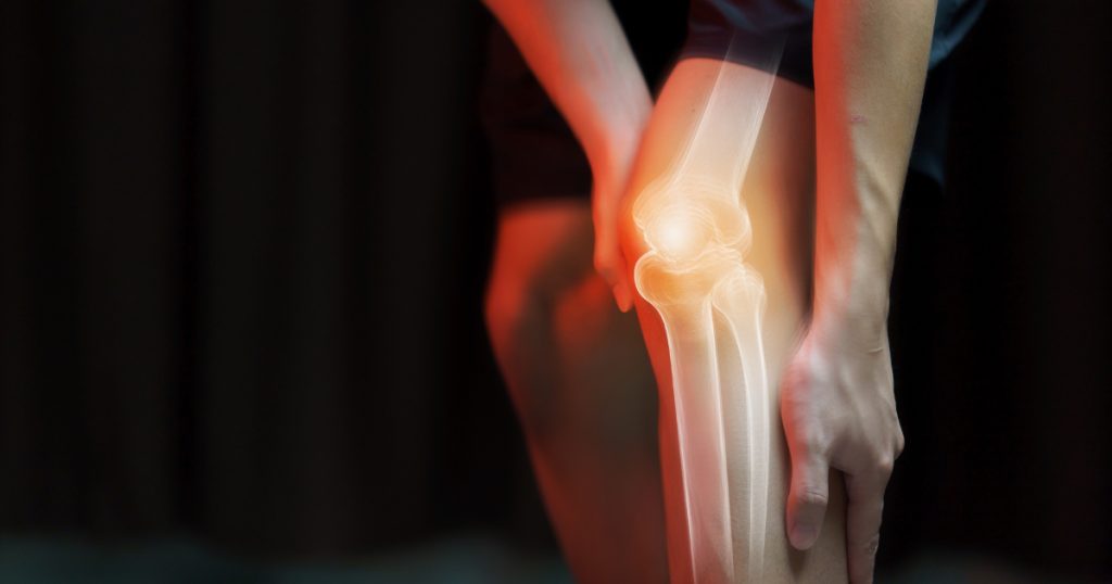 Entendendo a Artrose: Causas, Sintomas e Tratamentos