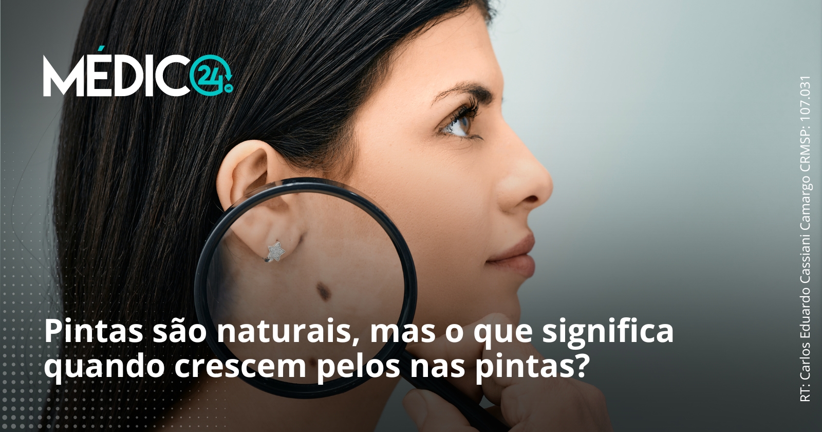 Pintas são naturais, mas o que significa quando crescem pelos nas pintas?
