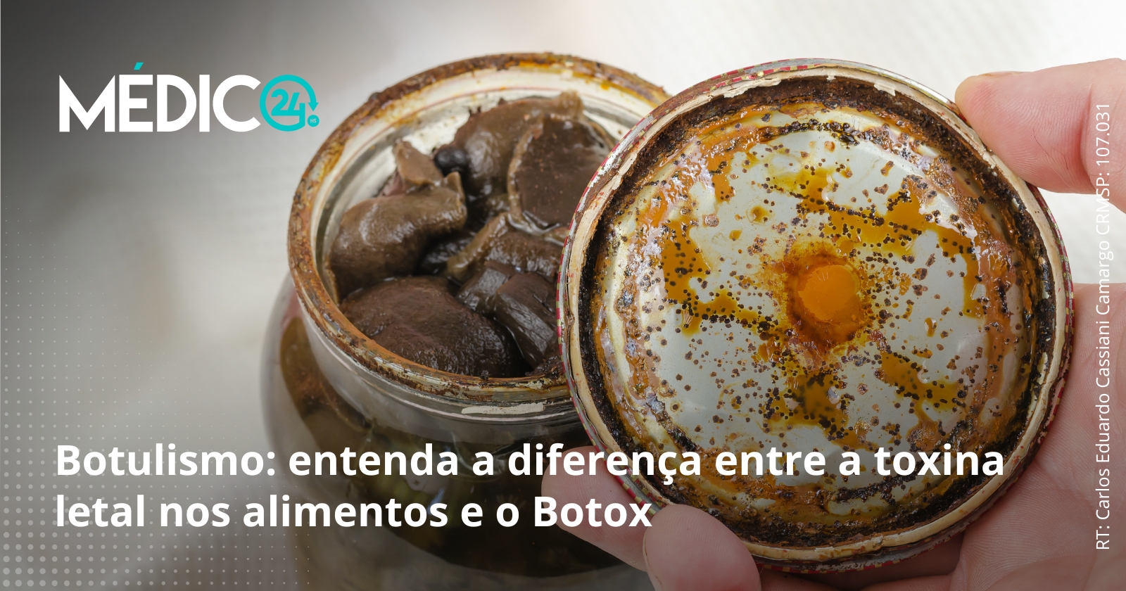 Botulismo: A toxina letal nos alimentos e a sua relação com o Botox